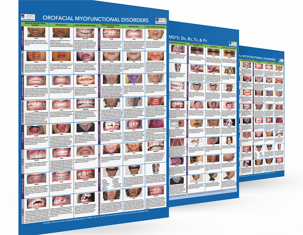 Orofacial Myofunctional Disorder Matrix Poster – AOMT